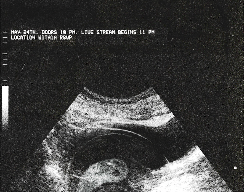 Shame Parade: Live Stream at TBA, Berlin